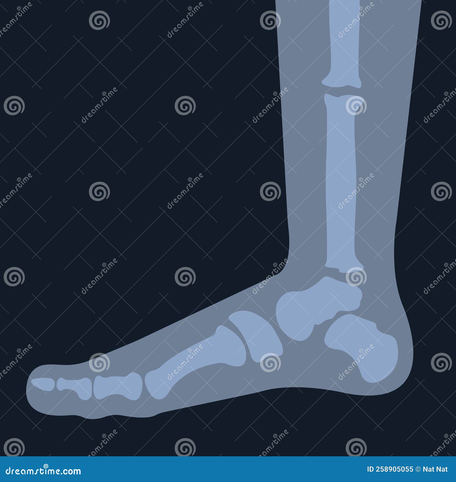 X-ray of the Foot Skeleton. Human Leg Bones Stock Illustration ...