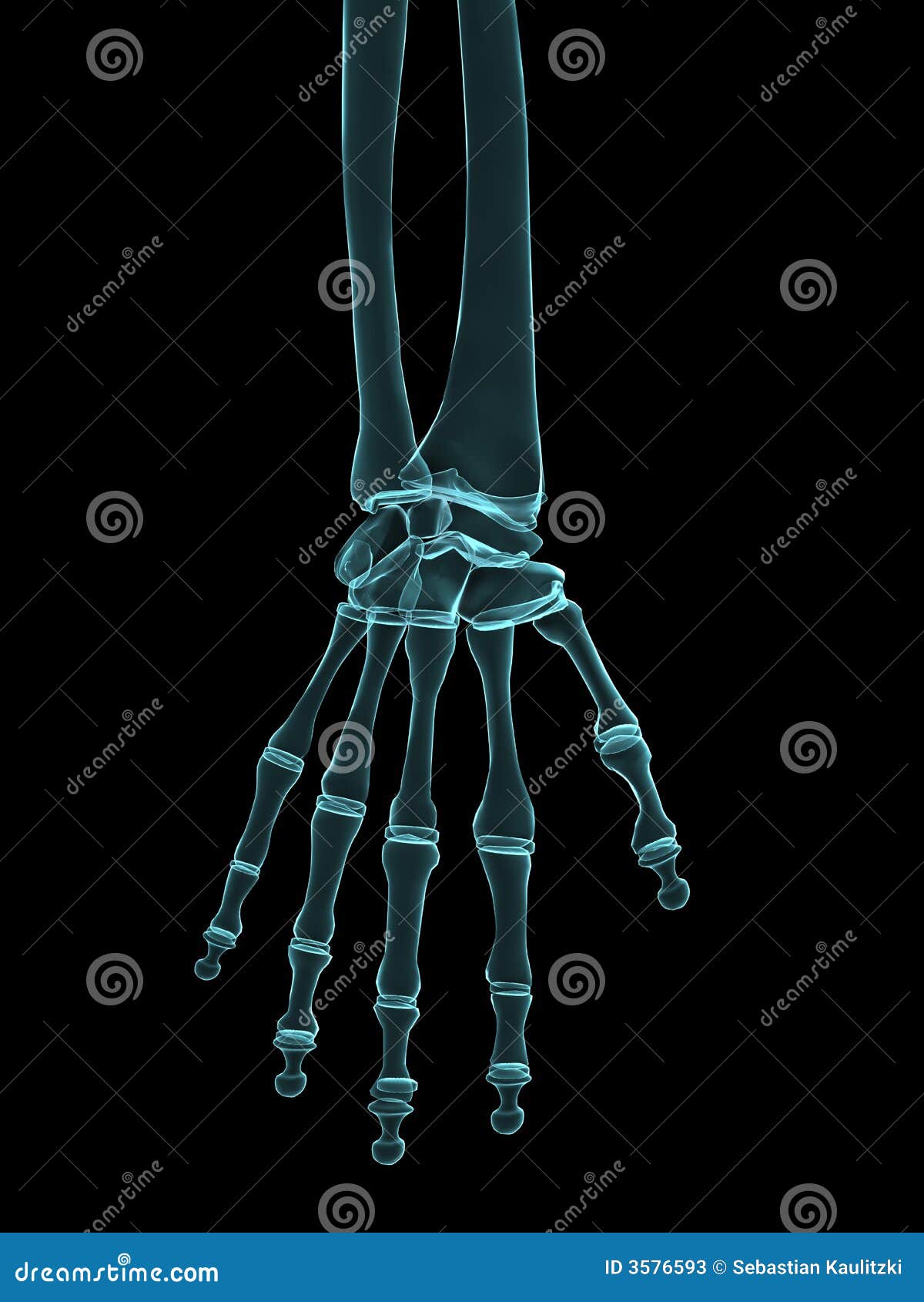 Xray Cartoon Hand