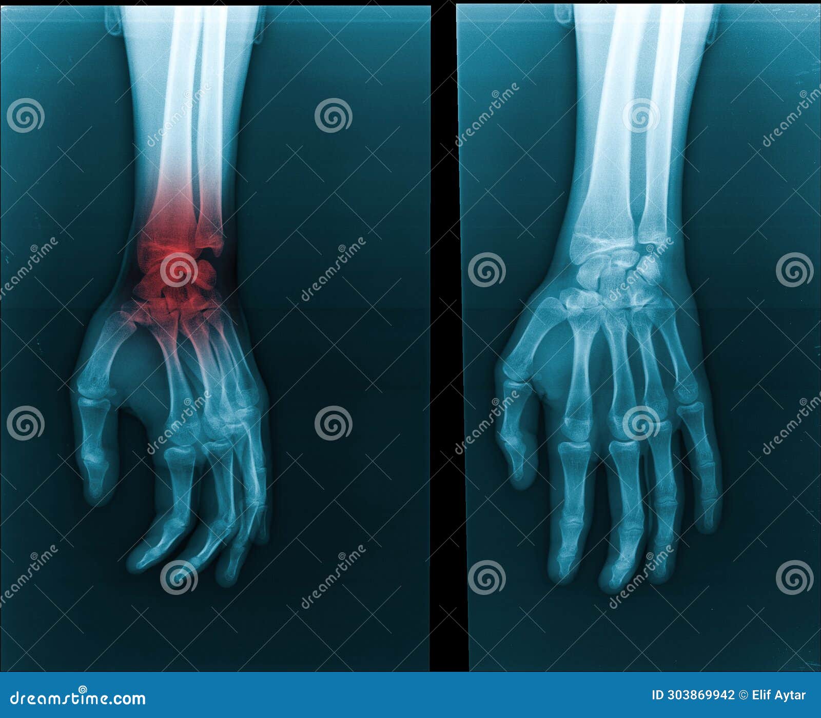 Highlighted Radius Stock Illustration | CartoonDealer.com #30723928