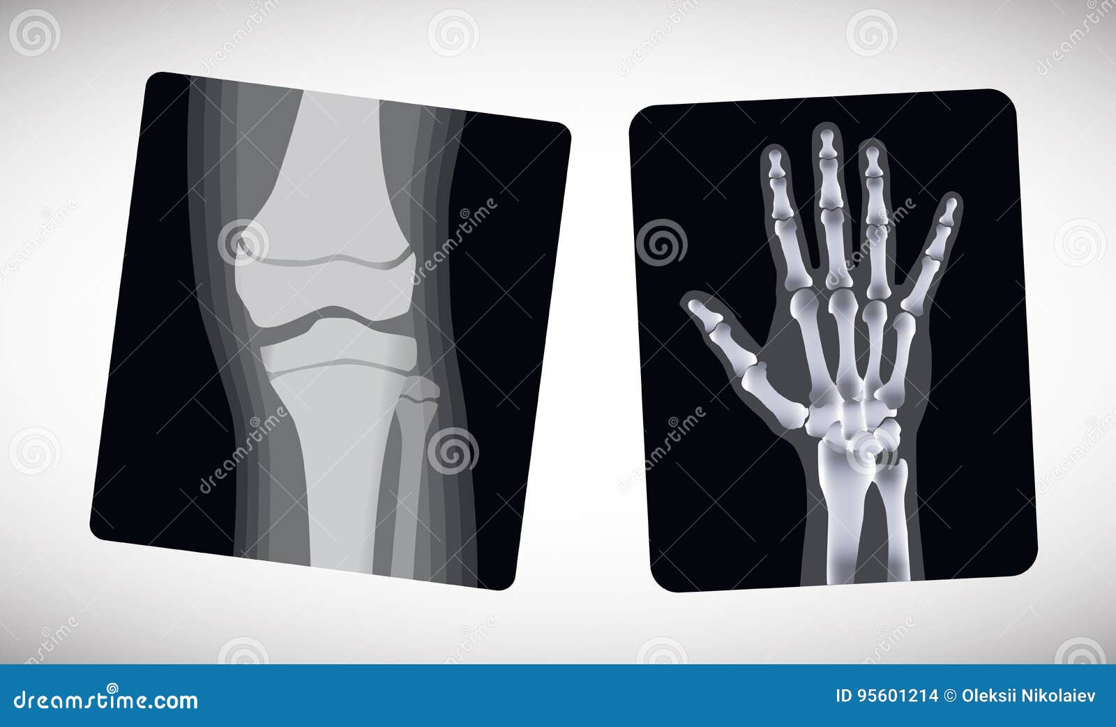 X-ray Of The Hand And Foot. Vector Stock Illustration | CartoonDealer ...