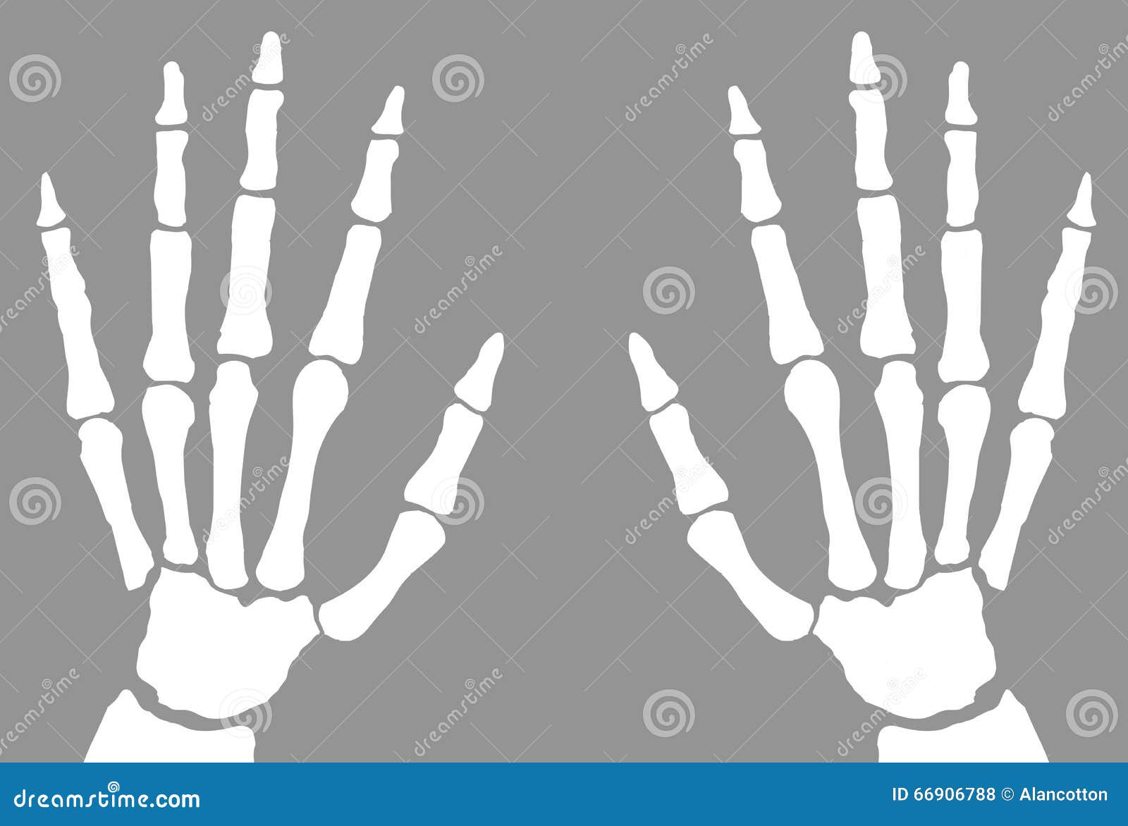X-Ray of Hands stock vector. Illustration of fingers - 66906788
