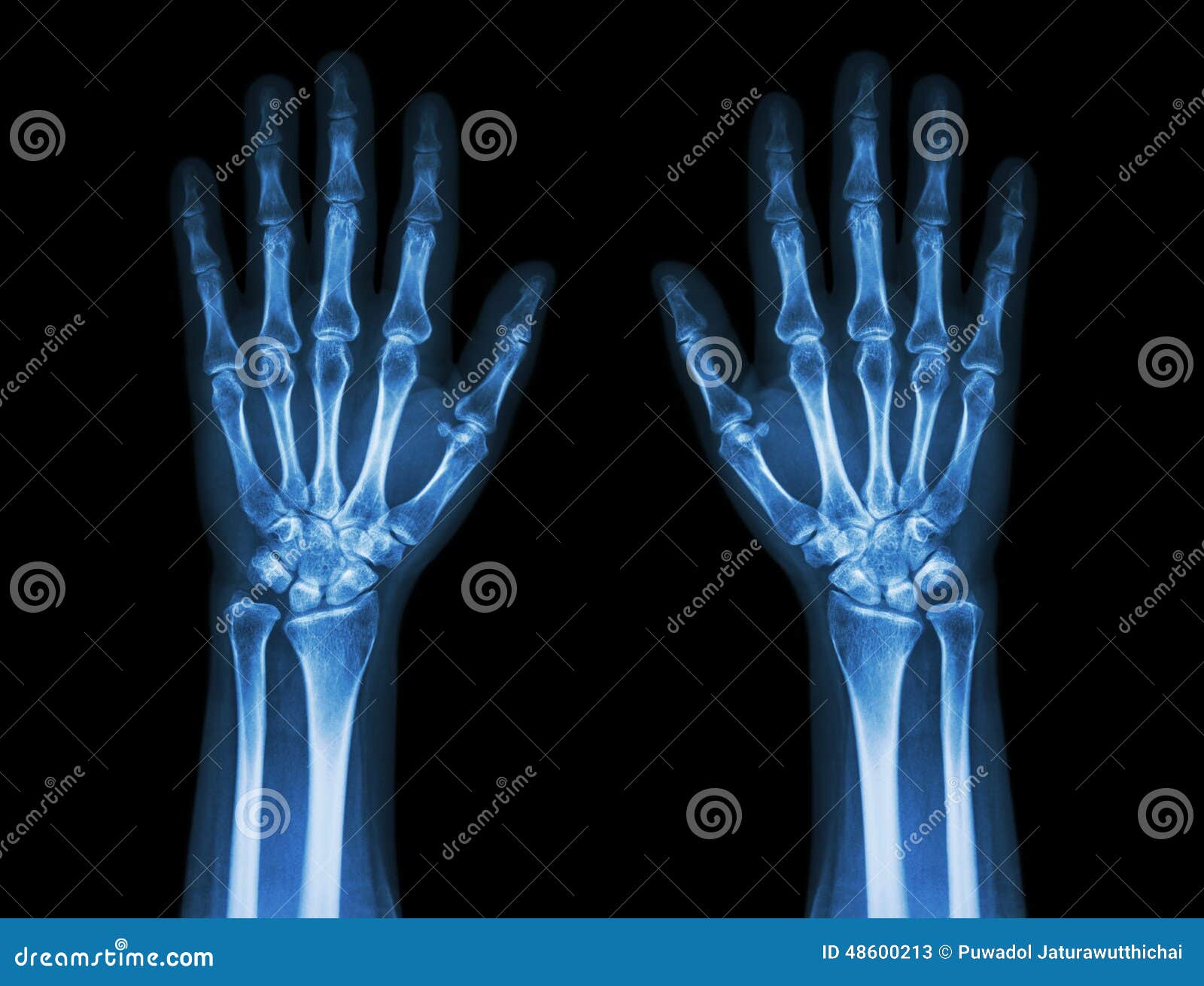 X-ray Normal Human Foot . Lateral View . Invert Color Style Royalty ...