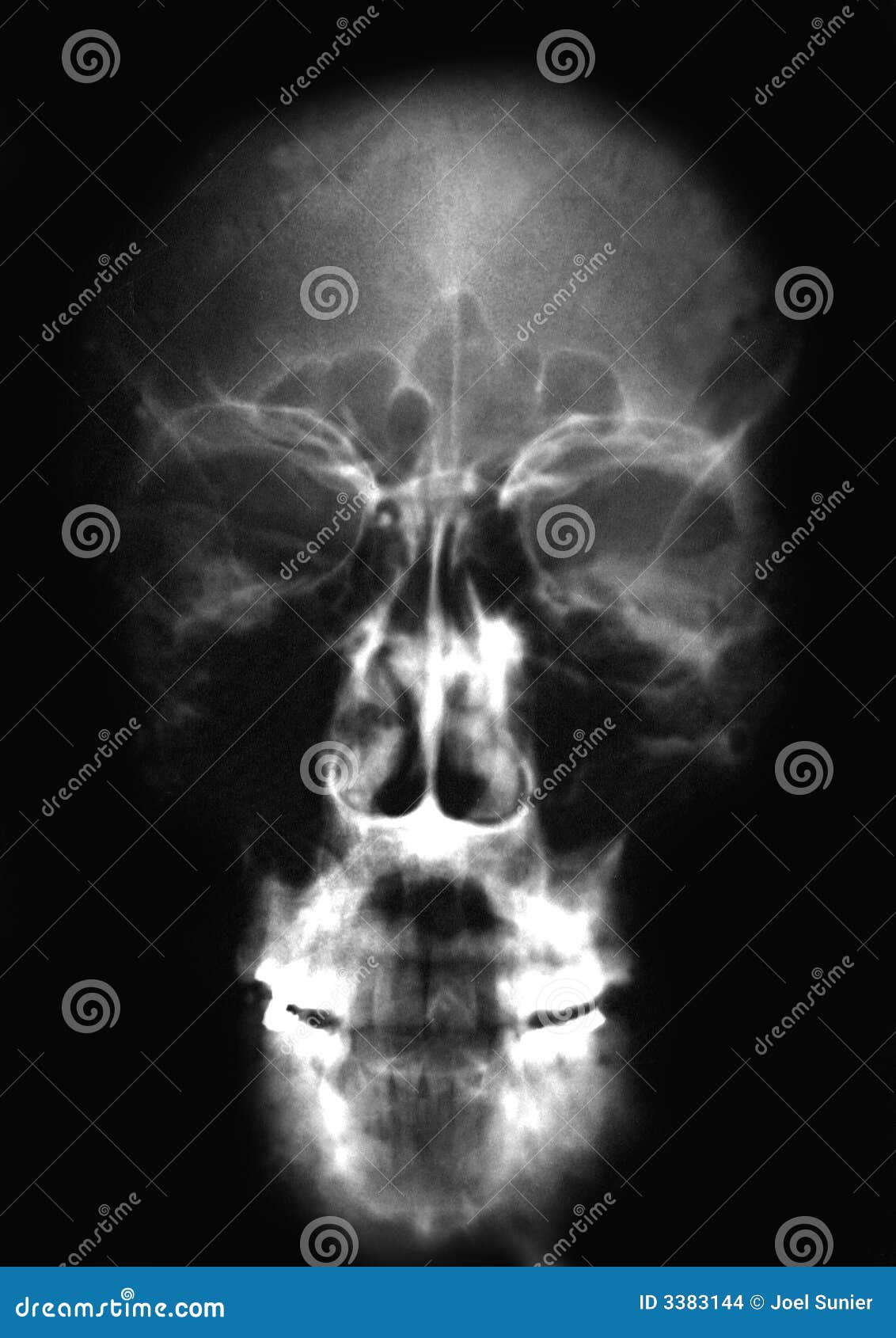 X-ray head stock photo. Image of woman, white, black, hospital - 3383144