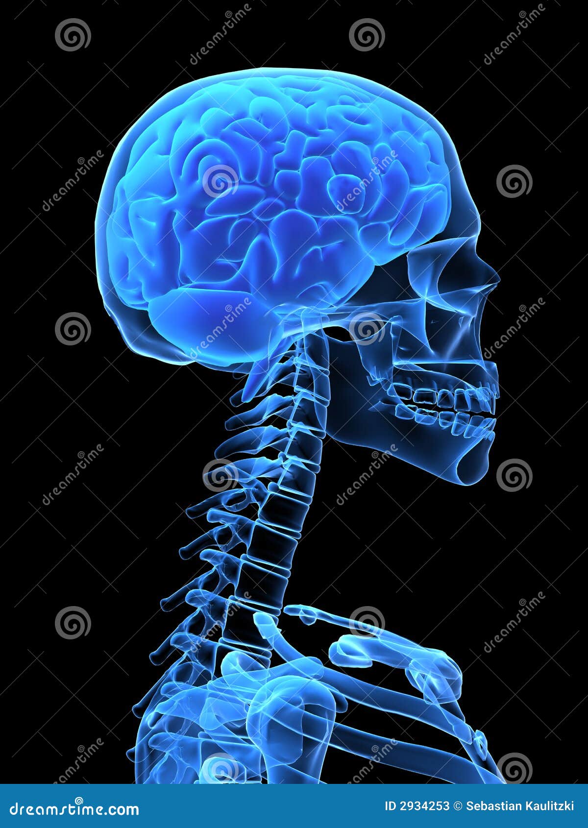 X Ray Brain