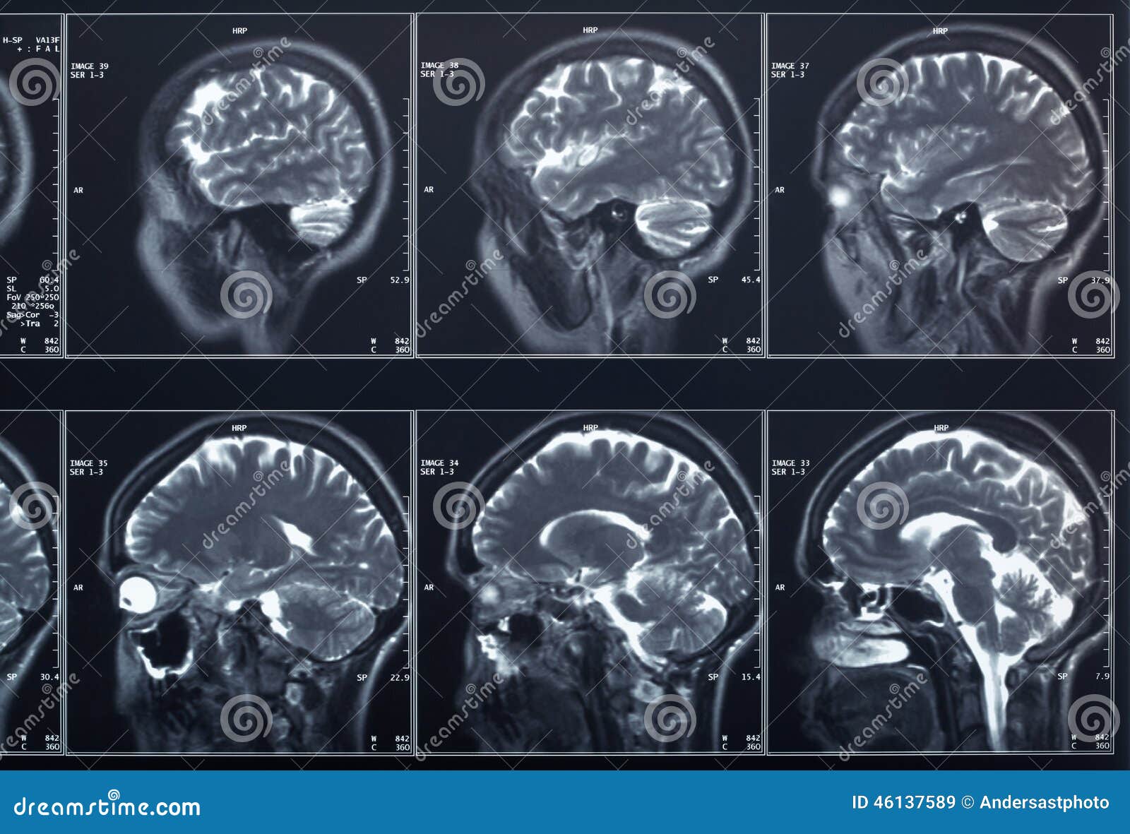 Brain X Ray Scan