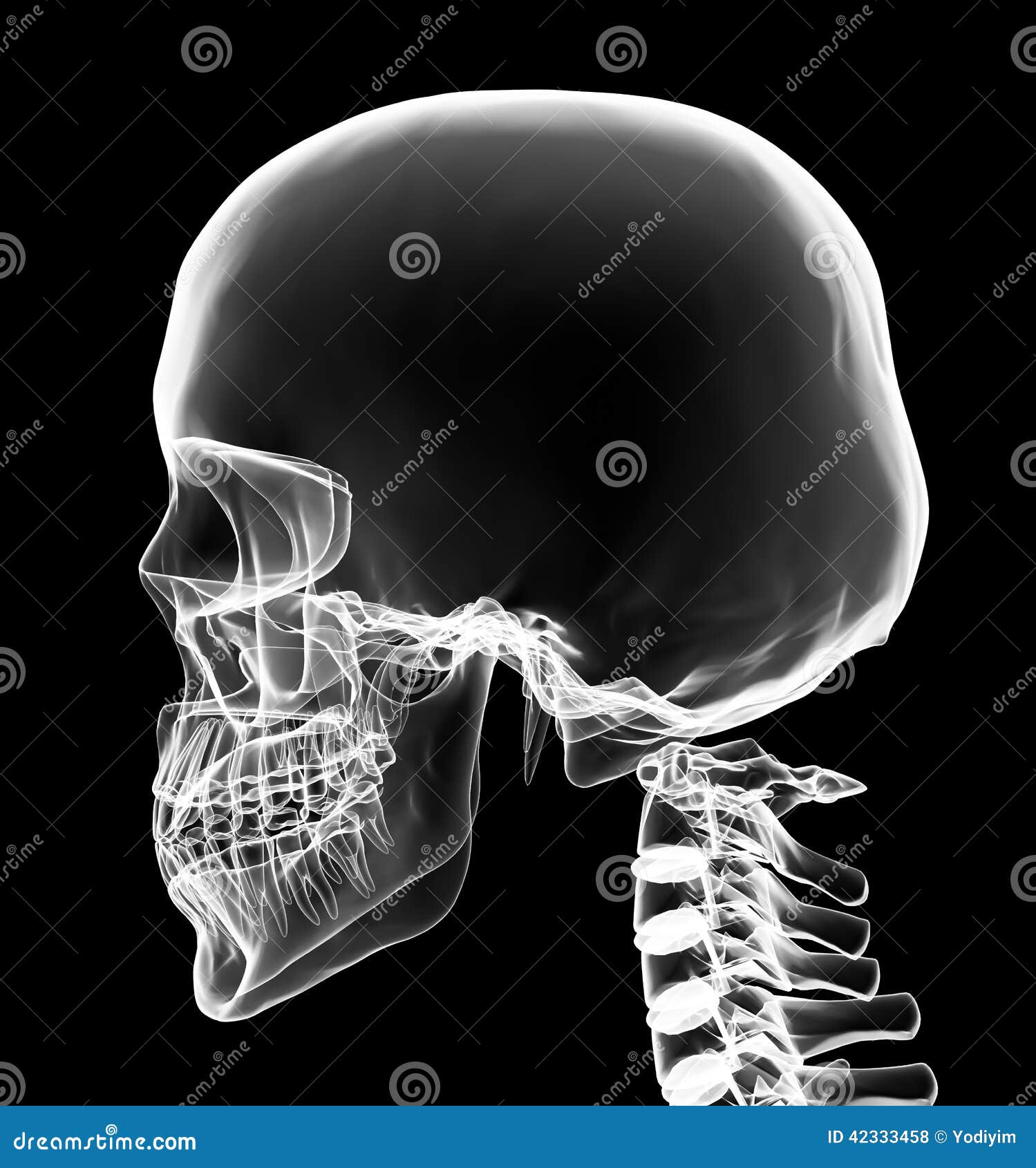 X-ray head and neck stock illustration. Illustration of computer - 42333458