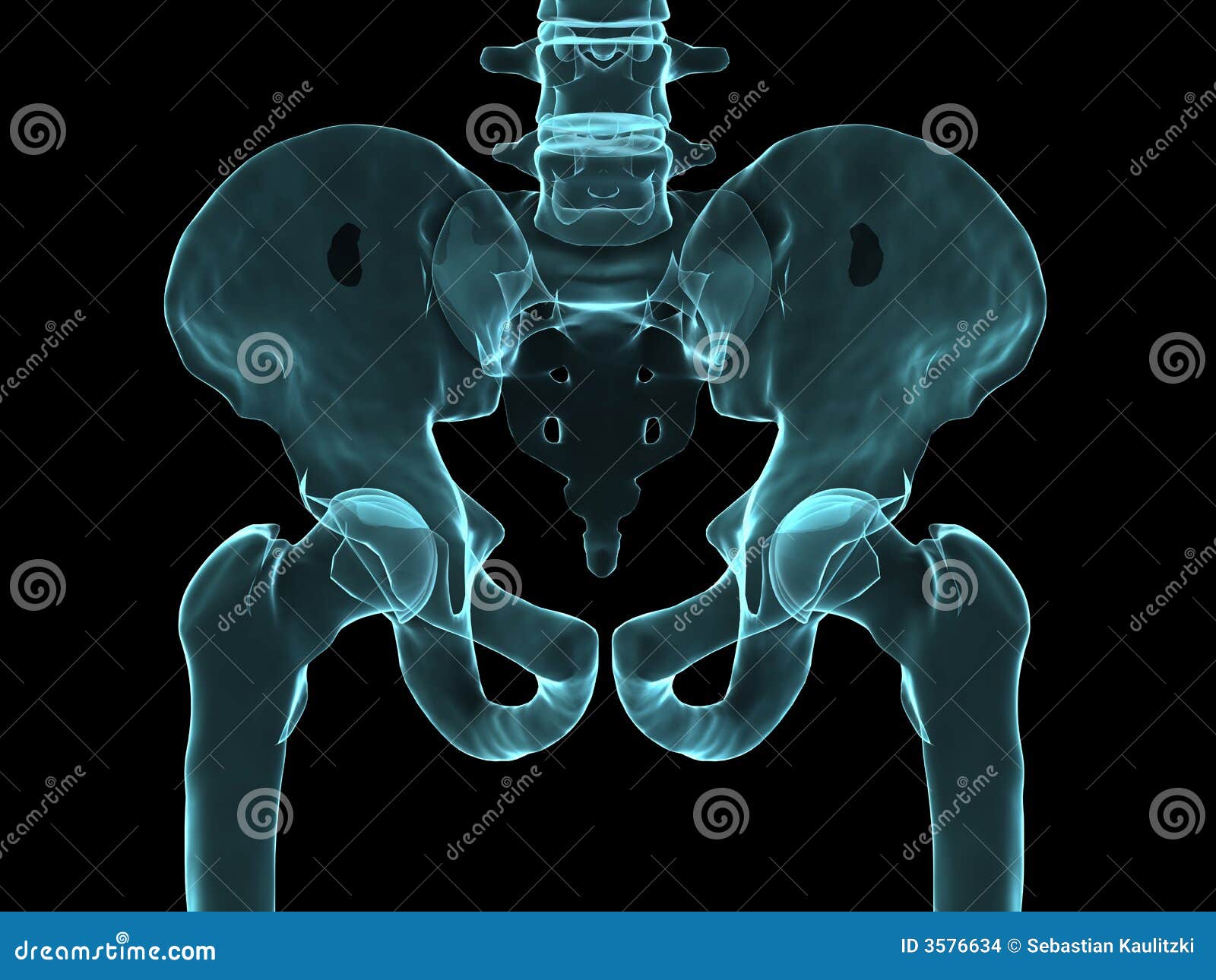 Hip X Ray Anatomy