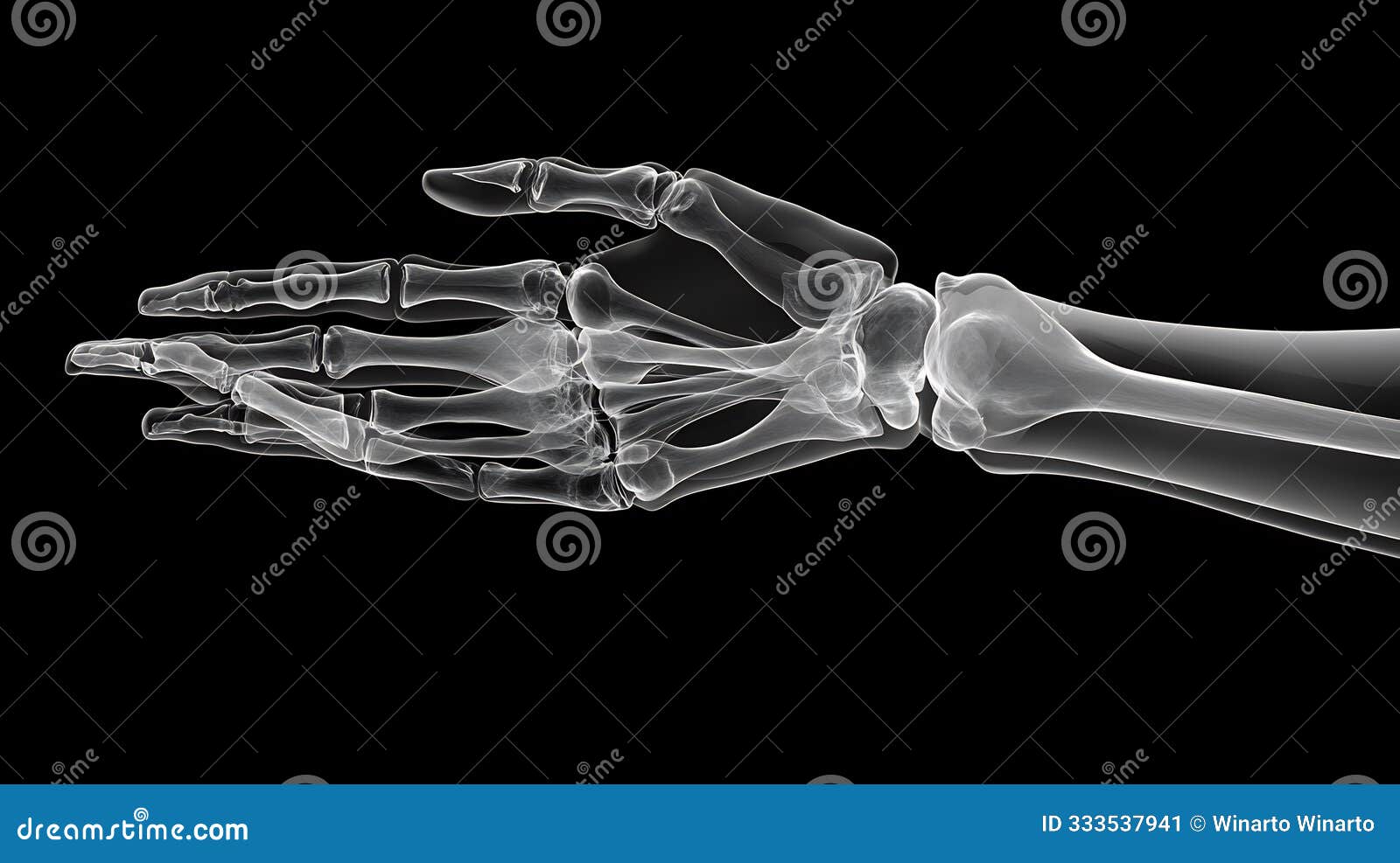 X-ray of a Human Arm Showing Bones Stock Image - Image of osteology ...
