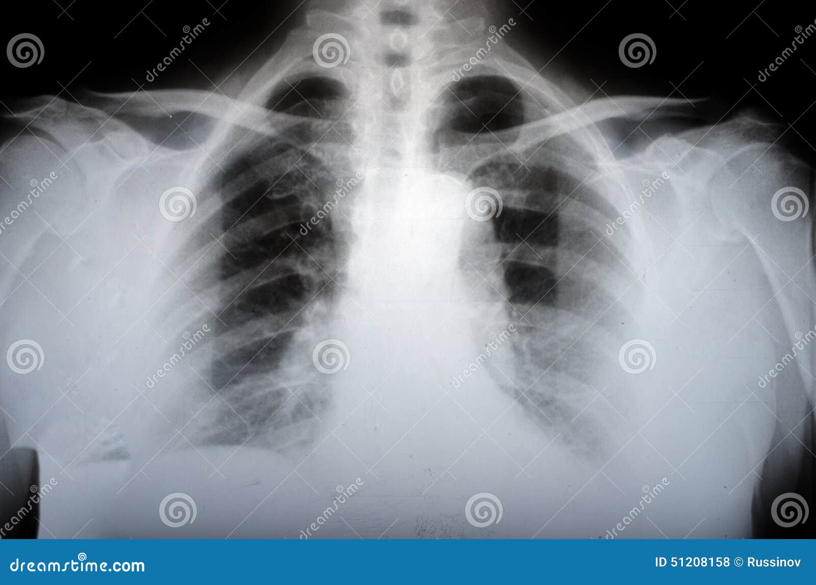 X-ray stock photo. Image of traumatology, human, patient - 51208158