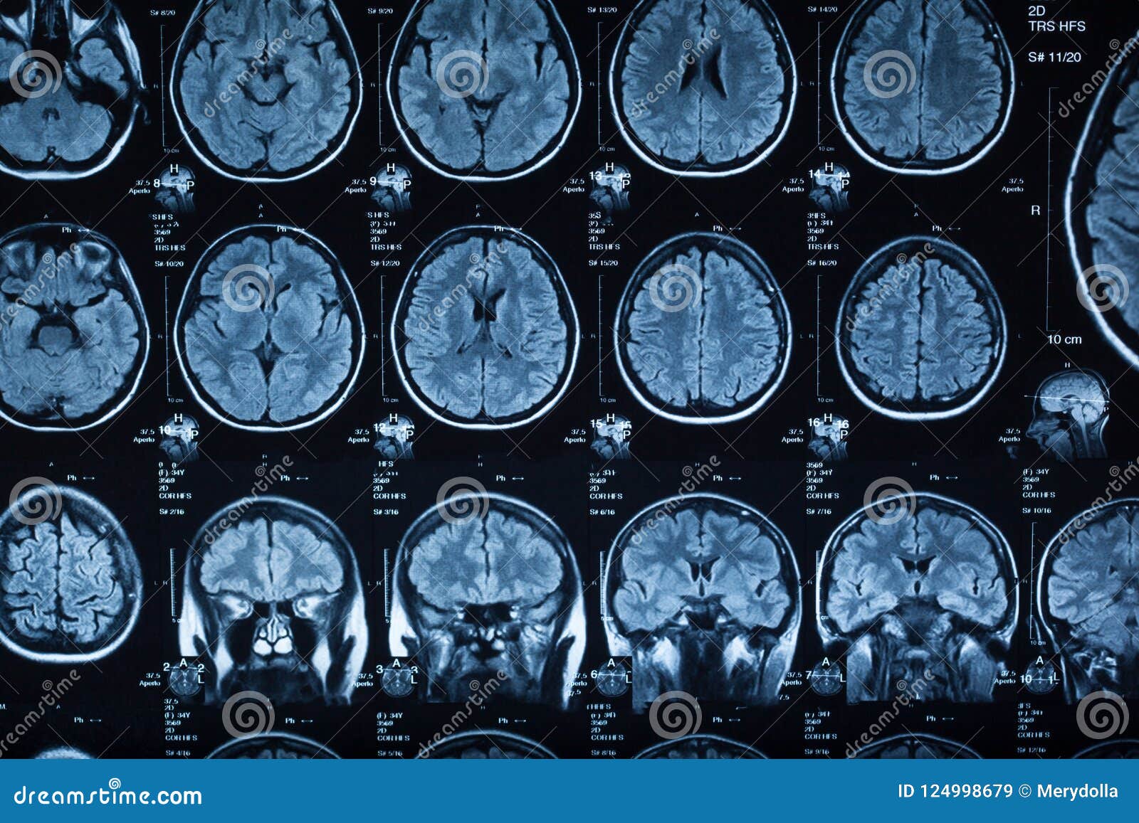 The X-ray of the Human Brain Stock Image - Image of health, healthcare ...