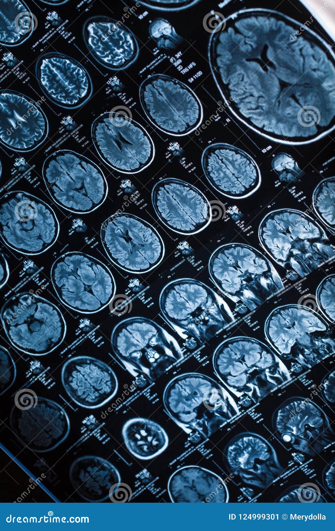 The X-ray of the Human Brain Stock Image - Image of magnetic, radiology ...