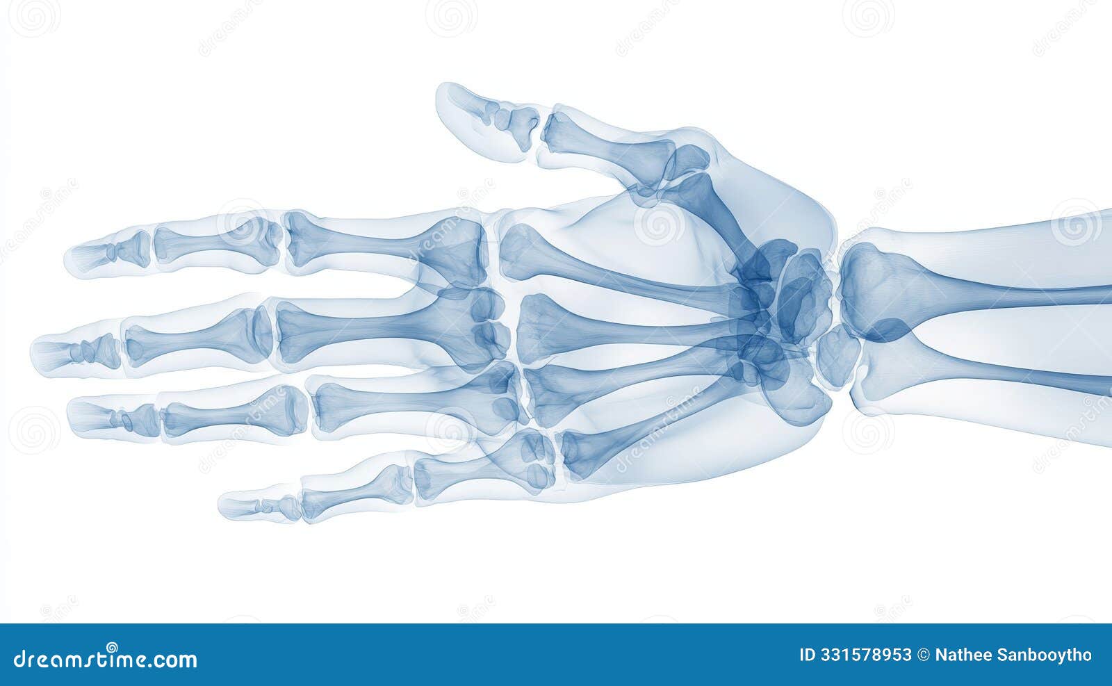 X-ray of Human Hand Bones, Top View Stock Illustration - Illustration ...