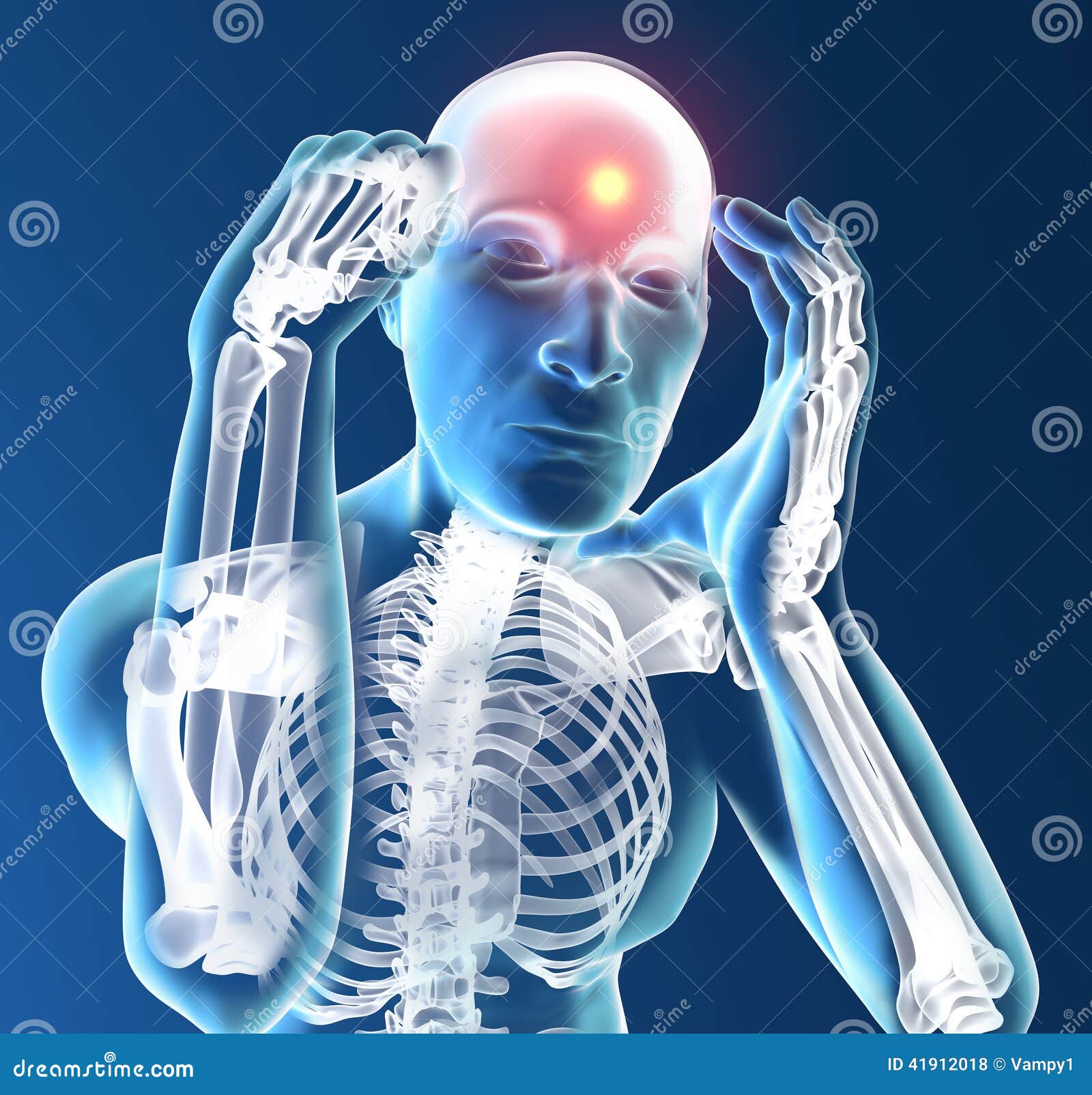 Photophobia And Human Mind - Pictured As Word Photophobia Inside A Head ...