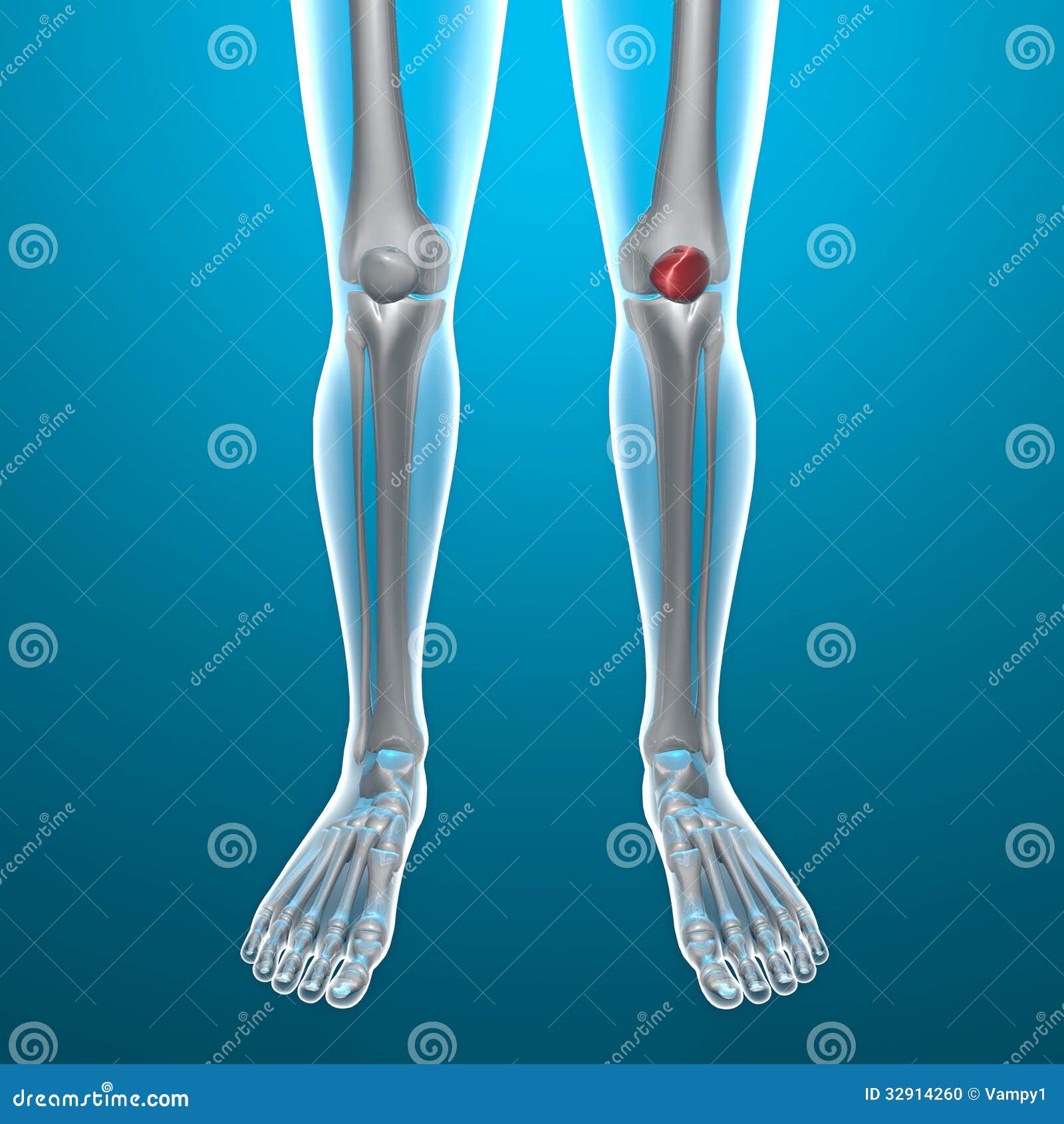 X-ray of human legs, knee stock illustration. Illustration of health ...