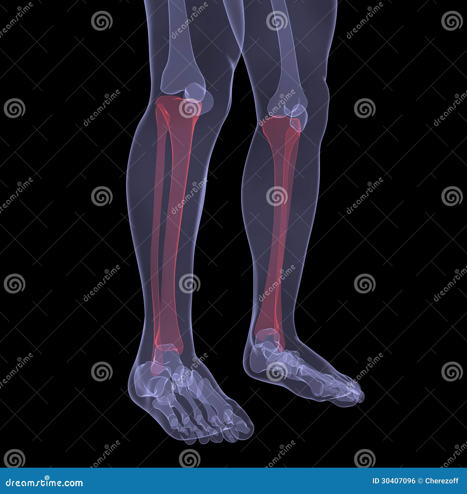 X-ray of human legs stock illustration. Illustration of cast - 30407096