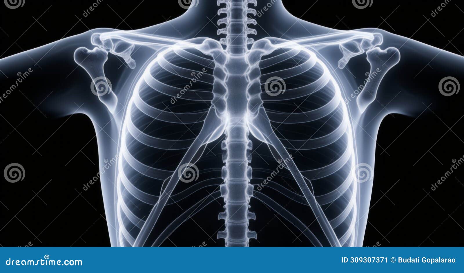 An X-ray of the Human Ribcage and Spine, Highlighting the Complex ...