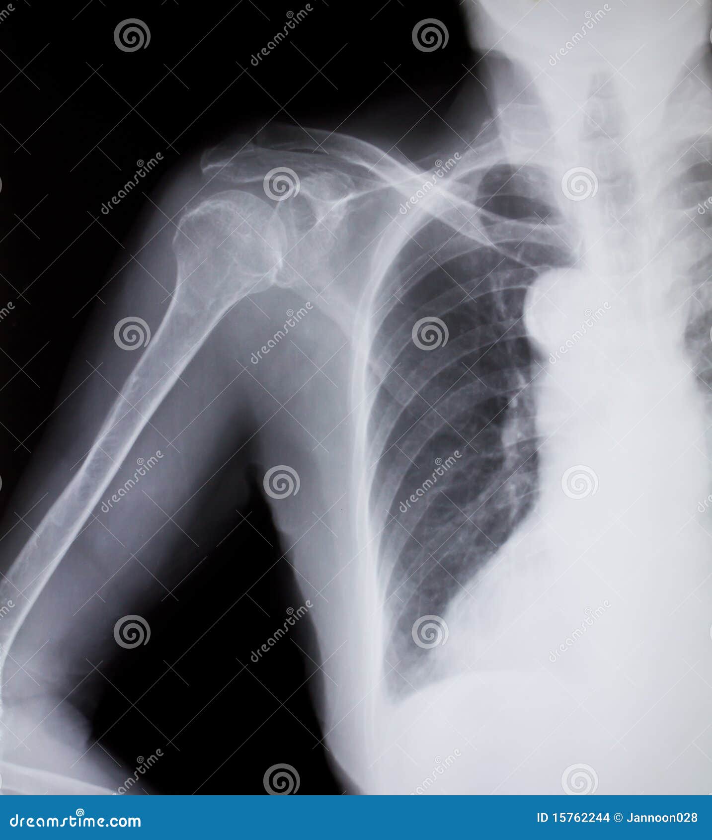 Shoulder Ap Stock Photos - Free & Royalty-Free Stock Photos from Dreamstime