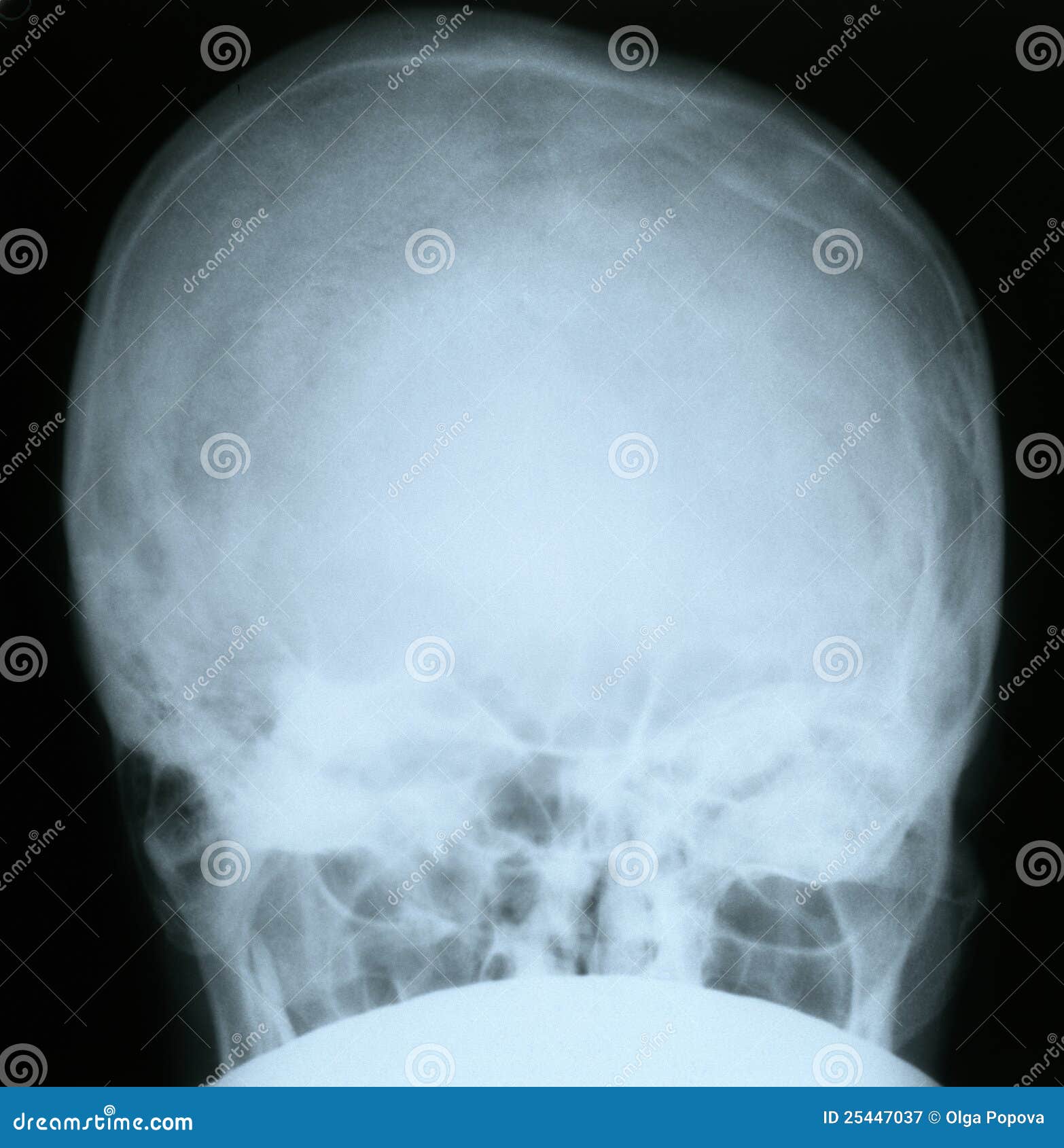 X-ray of a human skull stock image. Image of photograph - 25447037