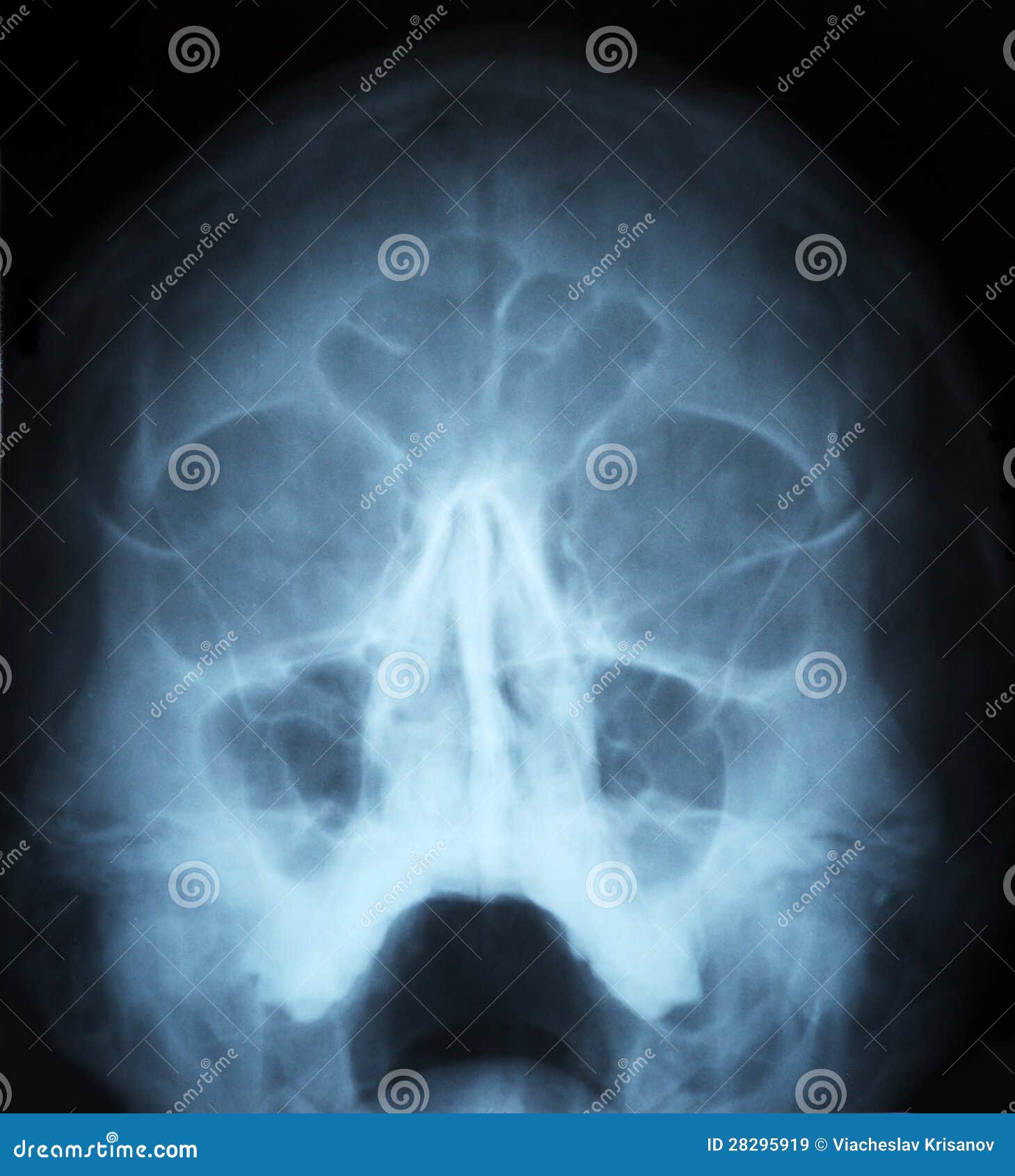 X-ray of human skull stock image. Image of anatomy, black - 28295919