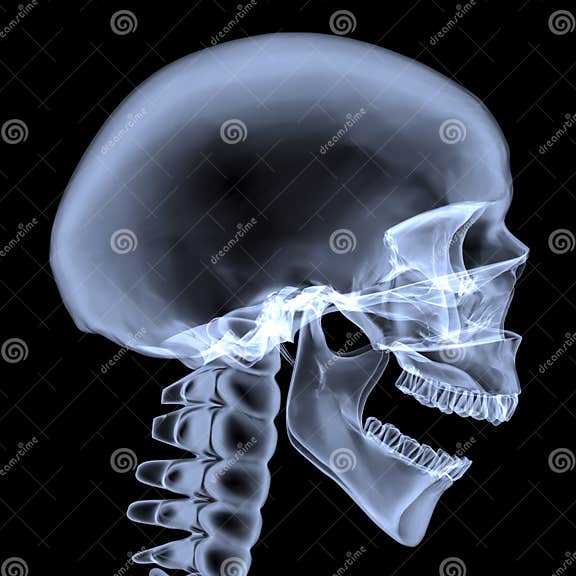 X-ray of the Human Skull. Side View Stock Illustration - Illustration ...