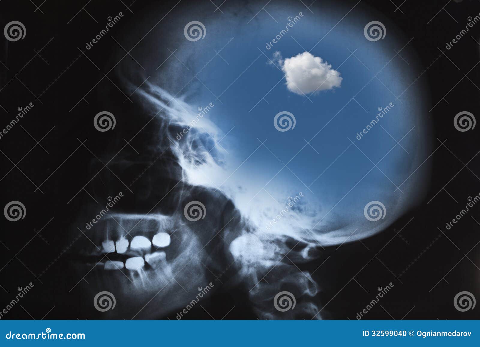 X-Ray of Human Skull with Sky Stock Photo - Image of scan, memory: 32599040