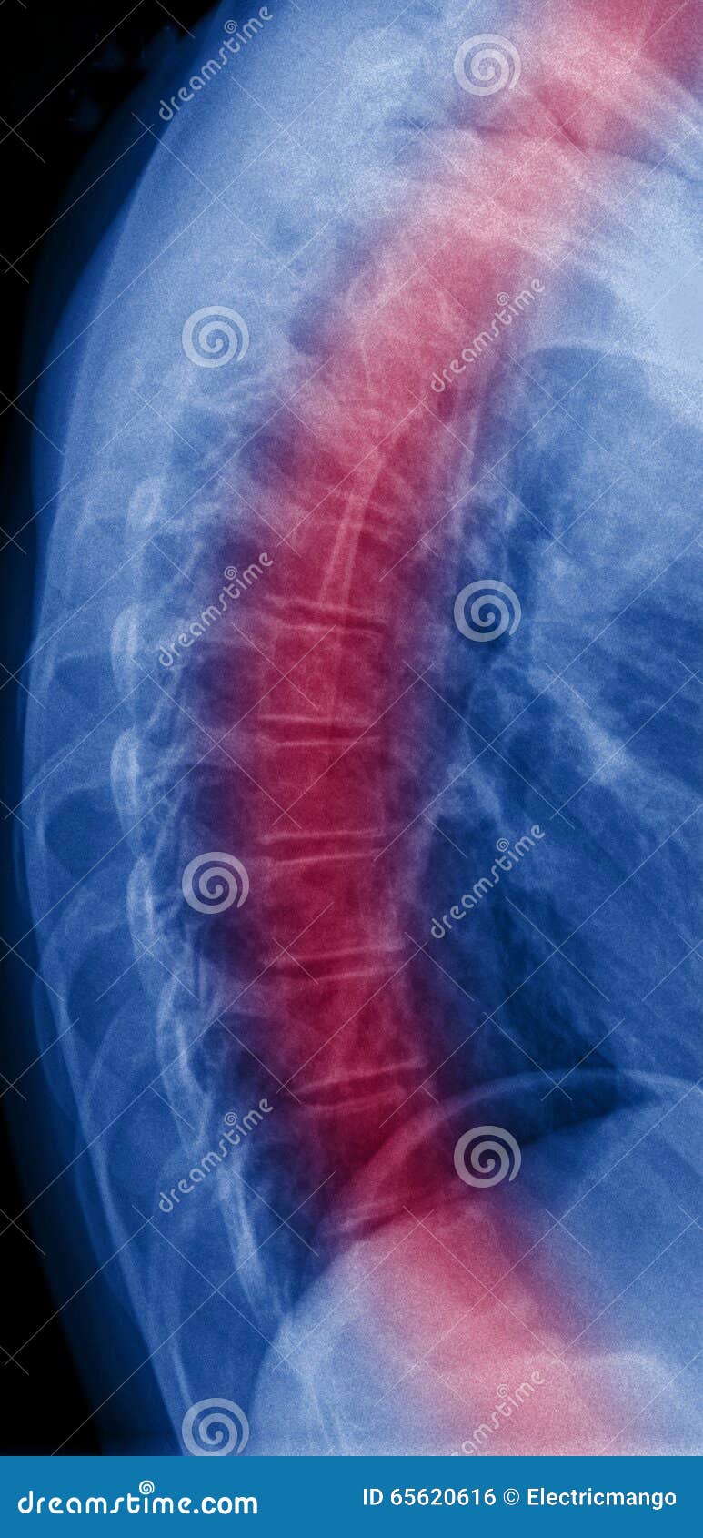 X-ray stock photo. Image of back, pink, exposure, roentgen - 65620616