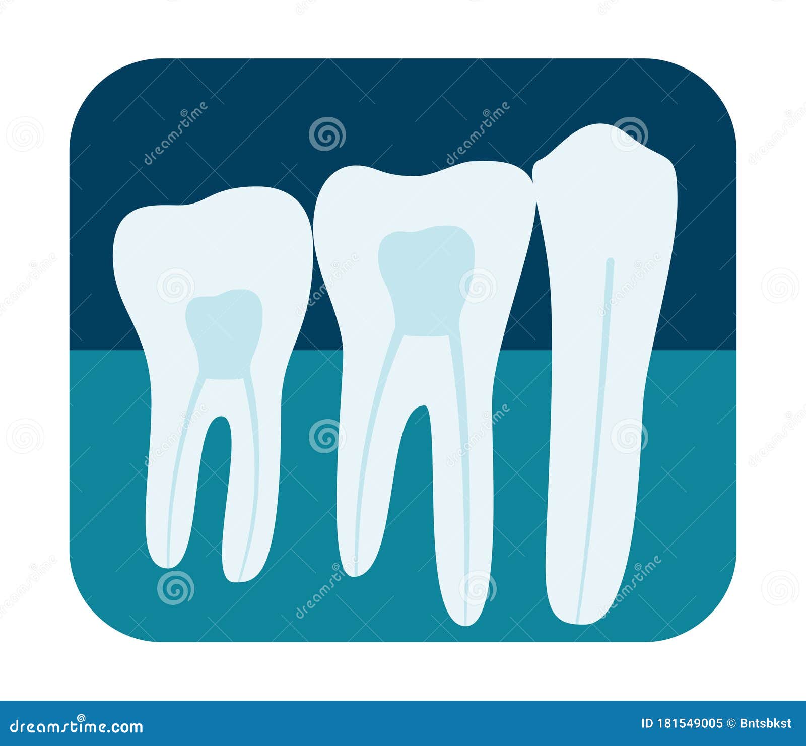 X-ray of Human Teeth. Three Healthy Molars on an X-ray Stock ...