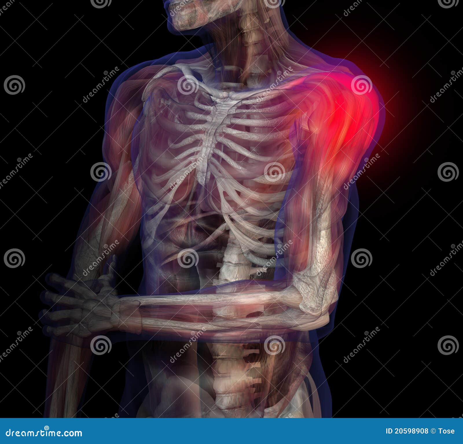 Shoulder Pain Pointer In Female Anatomy Silhouette Vector Illustration | CartoonDealer.com ...