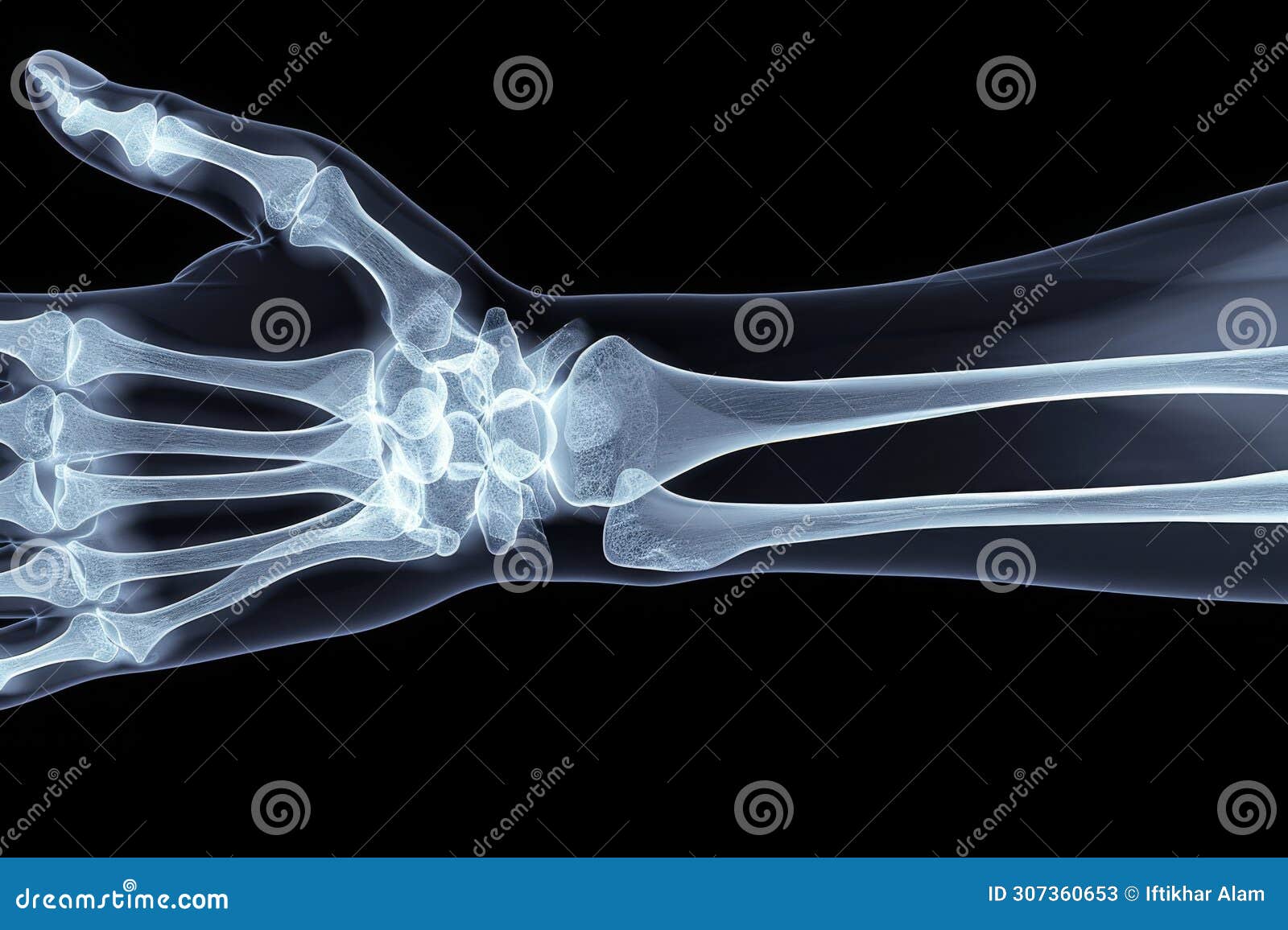 An X-ray Image Capturing the Intricate Details of a Skeletons Hand ...