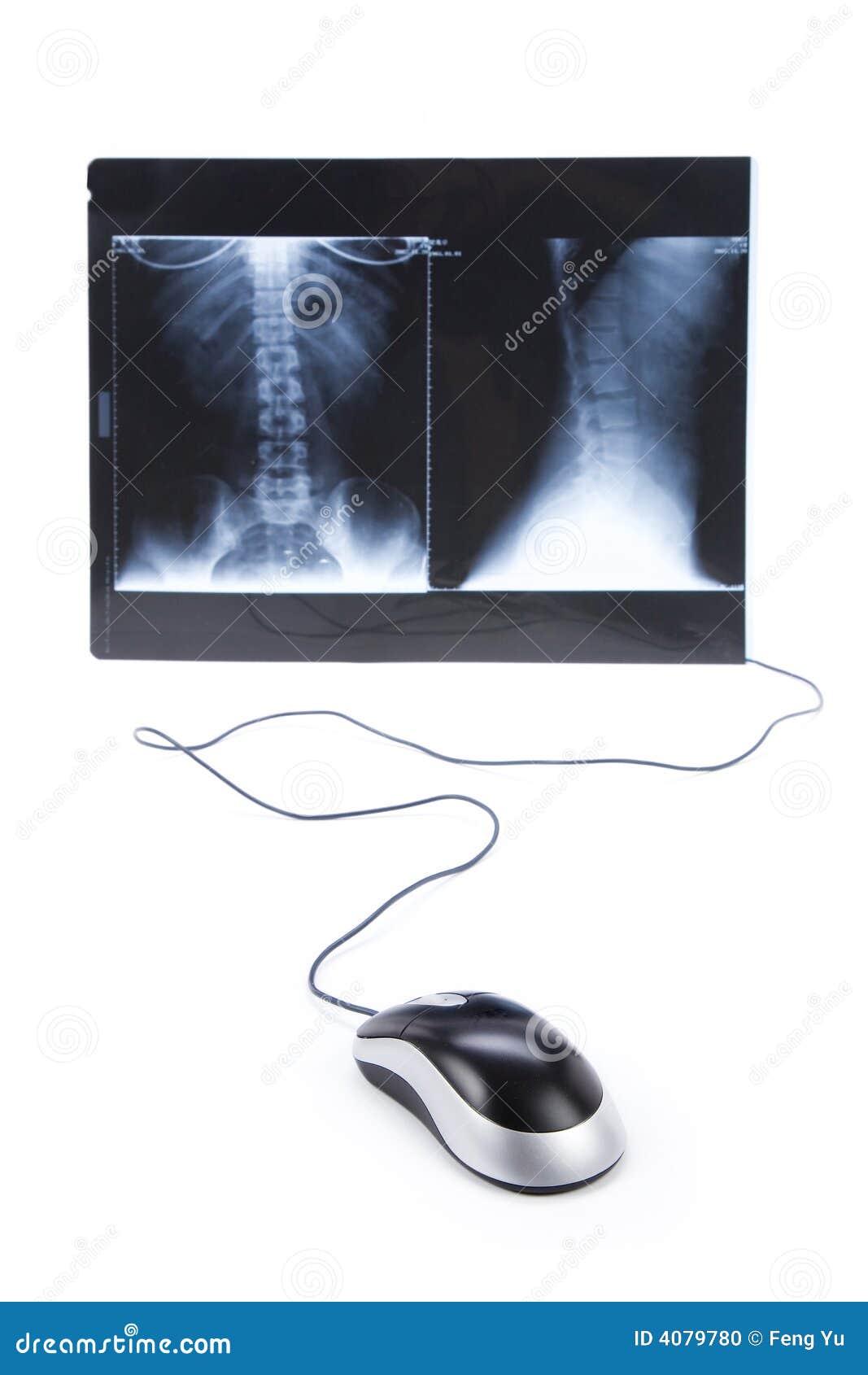 X-ray Image and Computer Mouse Stock Photo - Image of diagnoses, human ...