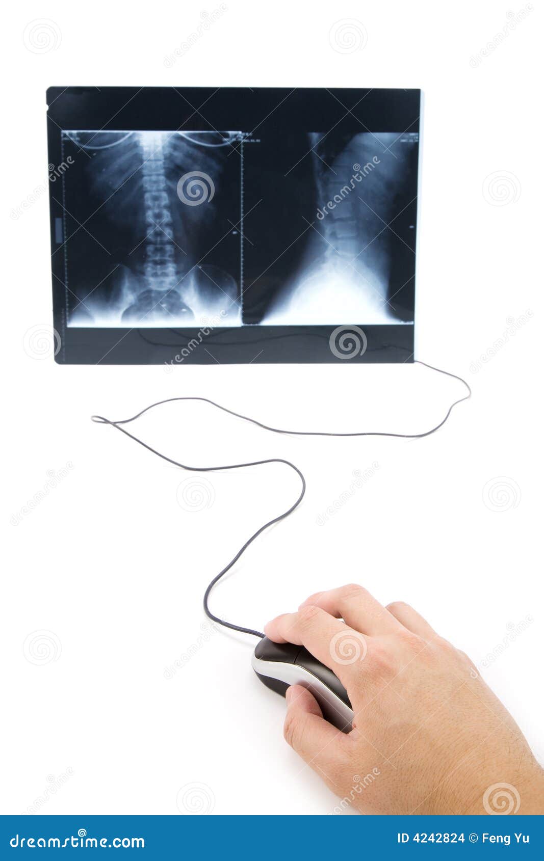 X-ray Image and Computer Mouse Stock Photo - Image of spine, exam: 4242824