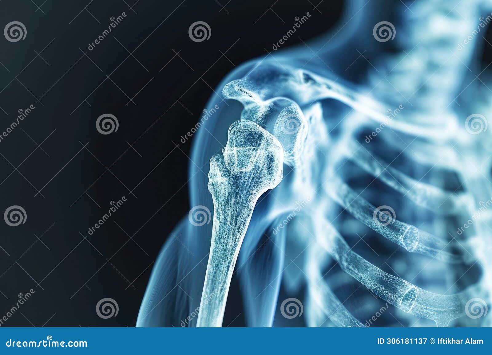 This X-ray Image Displays The Intricate Details And Structure Of A ...