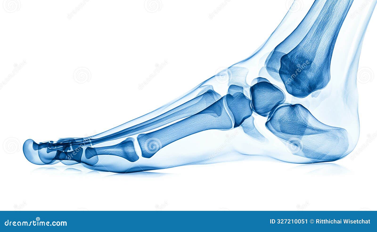 Arches Of The Foot Vector Illustration Drawing Labeled Drawing ...