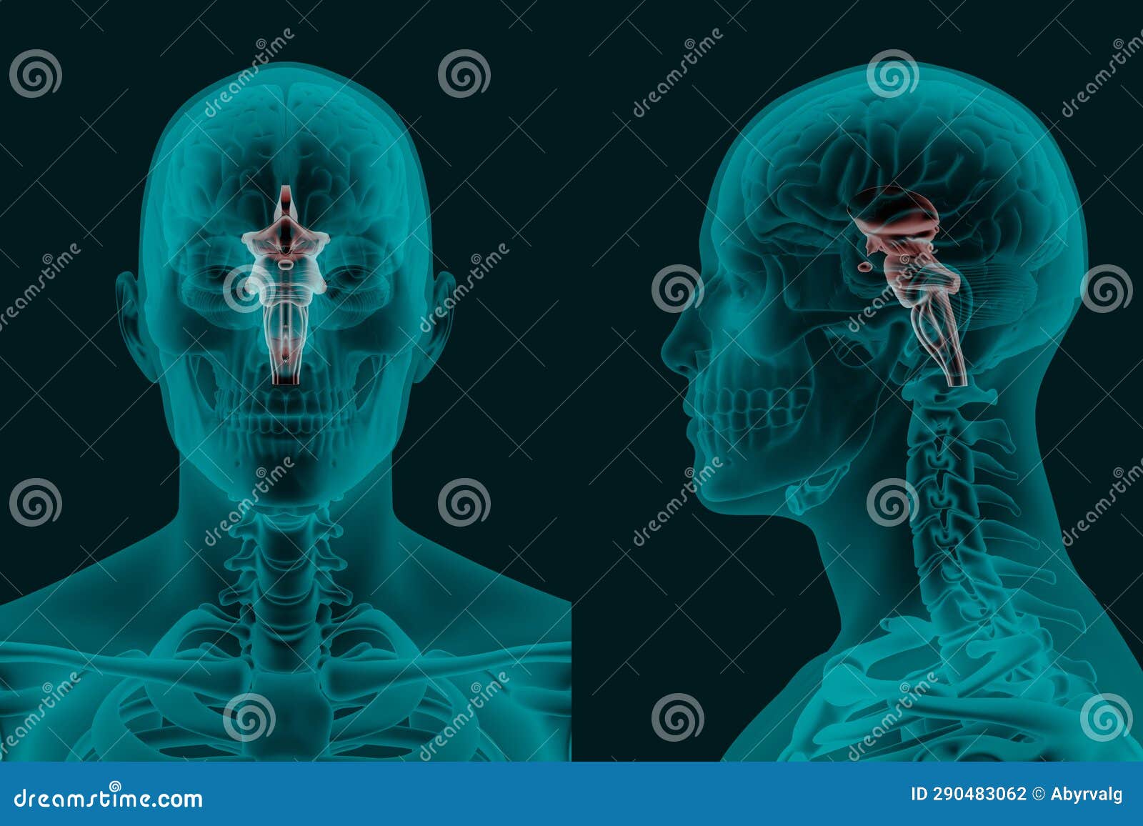 X-ray Image of the Human Brain Stem in Frontal and Lateral Projections ...