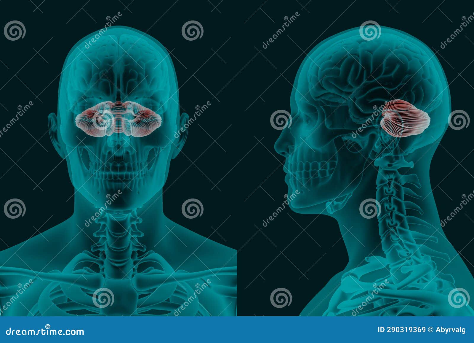 X-ray Image of the Human Cerebellum in Frontal and Lateral Projections ...