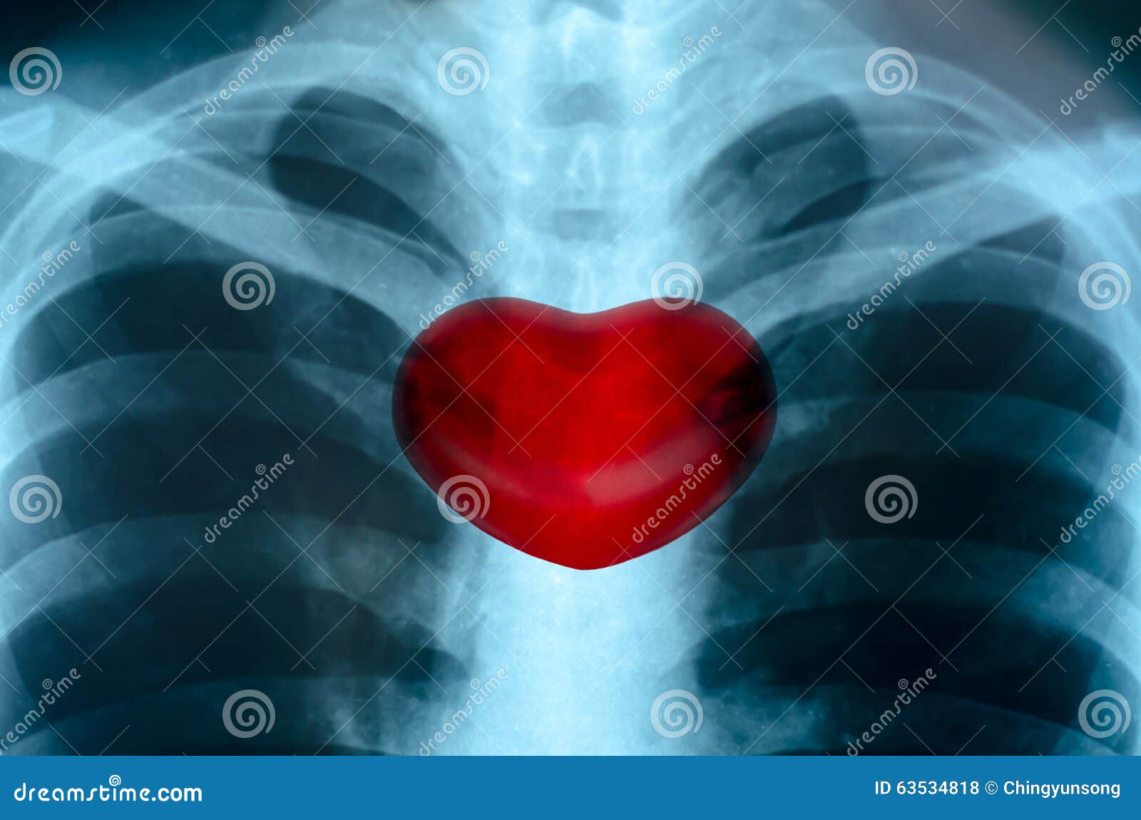 X-Ray Image Human Chest with Medical Structure of the Heart Stock Photo ...