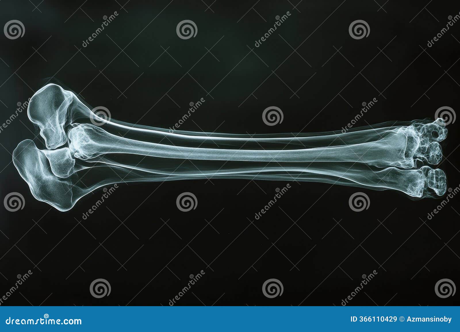 Human Forearm And Hand Bones Anatomy, Realistic 3D Model Stock ...