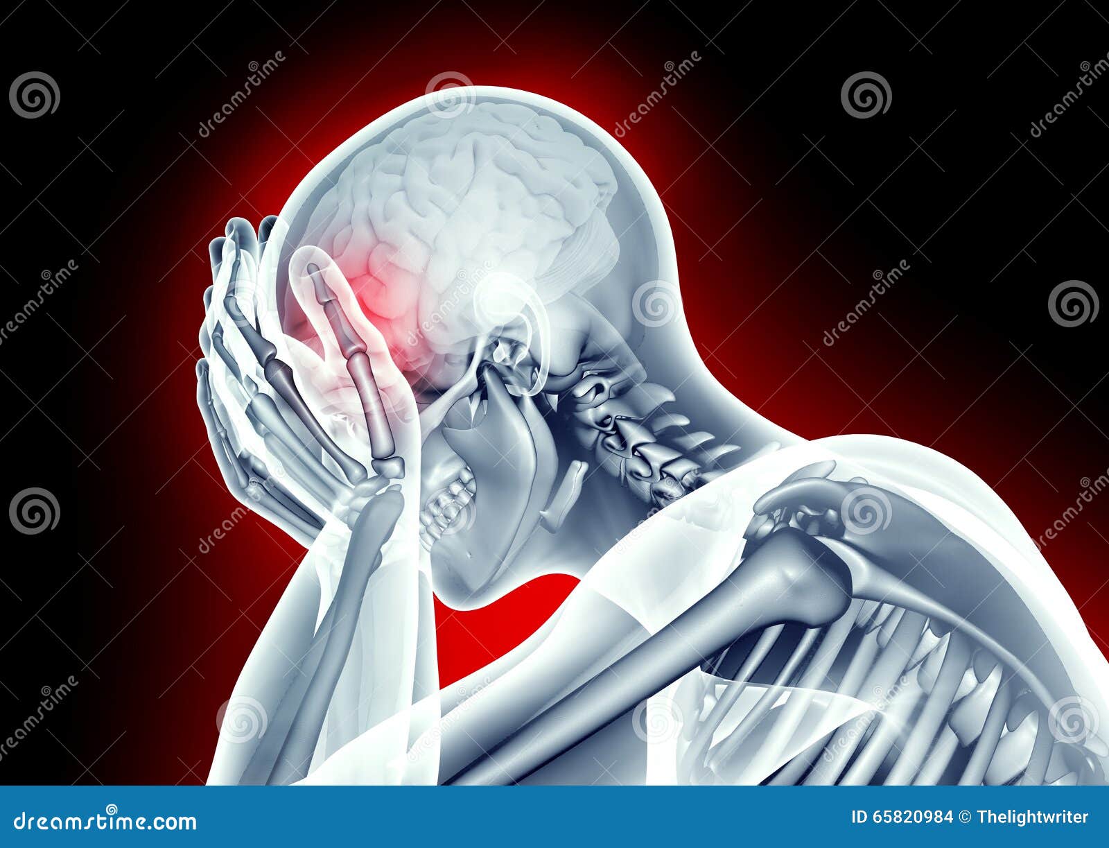 X-ray Image Human Head with Pain Stock Illustration - Illustration of ...