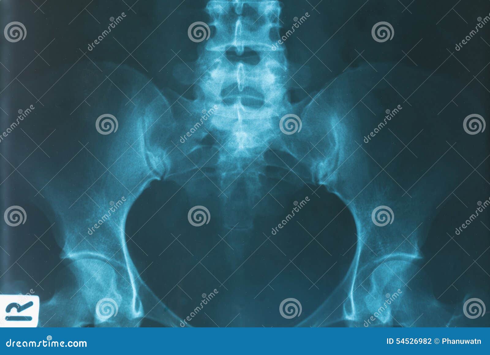 X-Ray Image of Human for a Medical Diagnosis Stock Photo - Image of ...