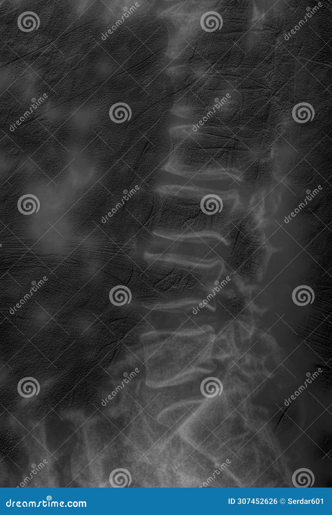 Backbone stock photo. Image of details, anatomy, radiology - 307452626