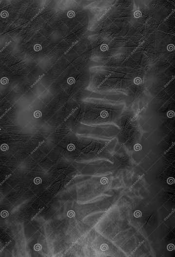 Backbone stock photo. Image of details, anatomy, radiology - 307452626