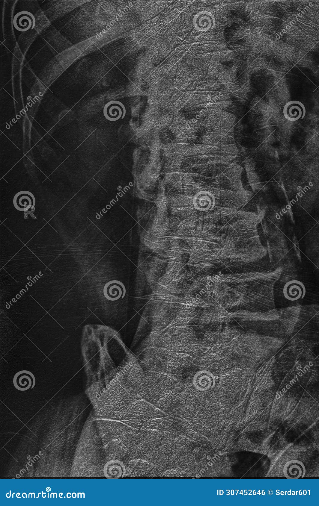 Backbone stock photo. Image of spine, radiologist, disease - 307452646