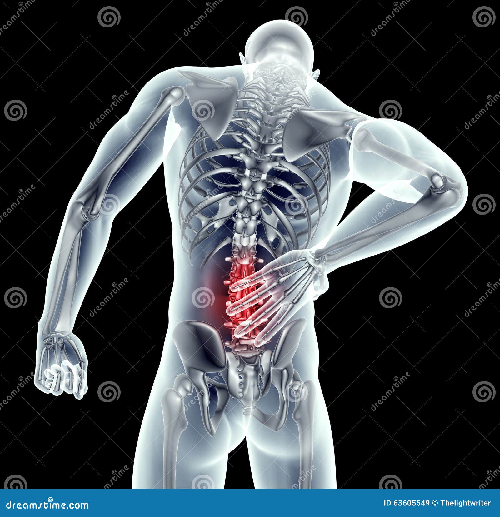 X-ray Image Man with Back Pain with Clipping Path Stock Illustration ...