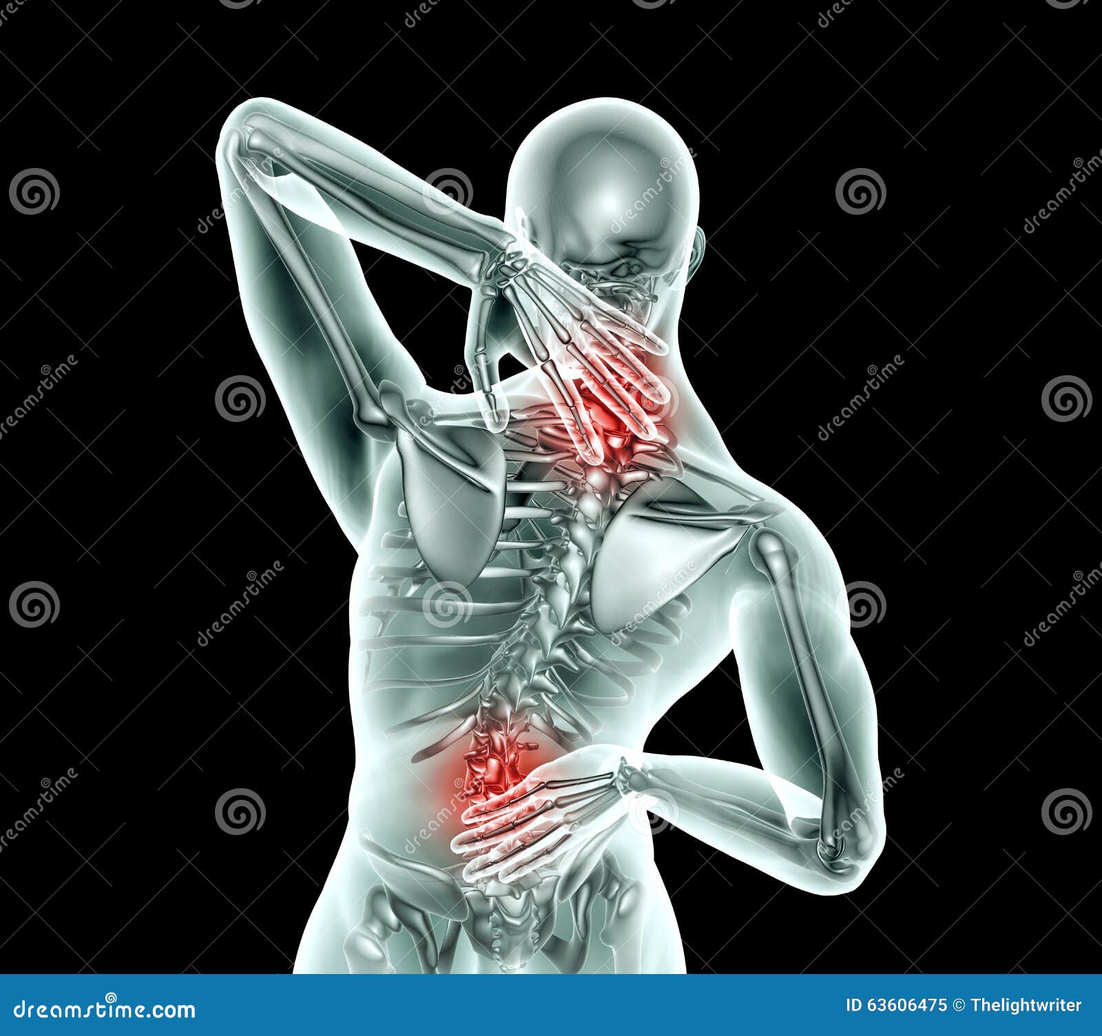 X-ray Image Man with Back Pain with Clipping Path Stock Illustration ...