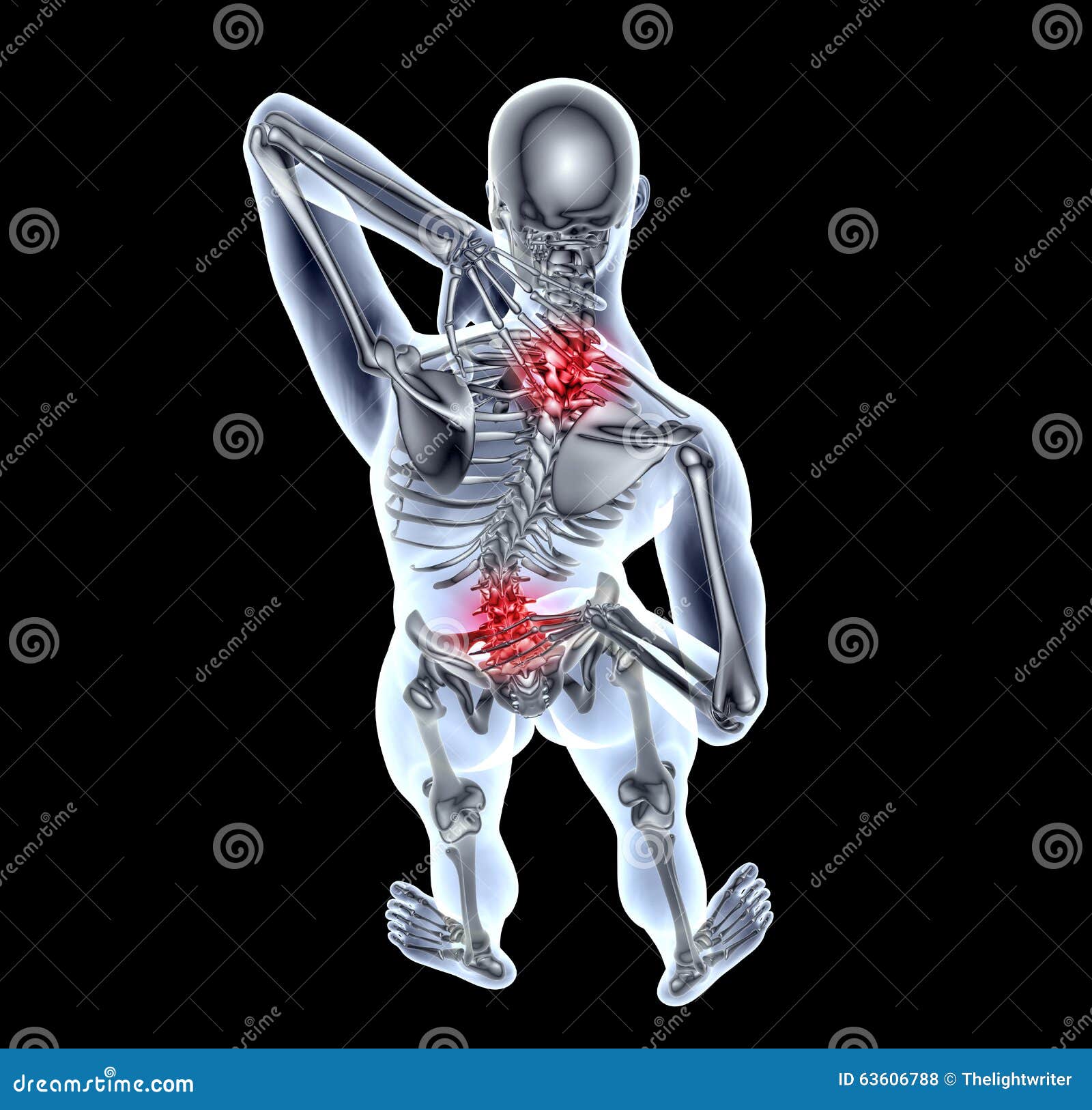 X-ray Image Man with Back Pain with Clipping Path Stock Illustration ...
