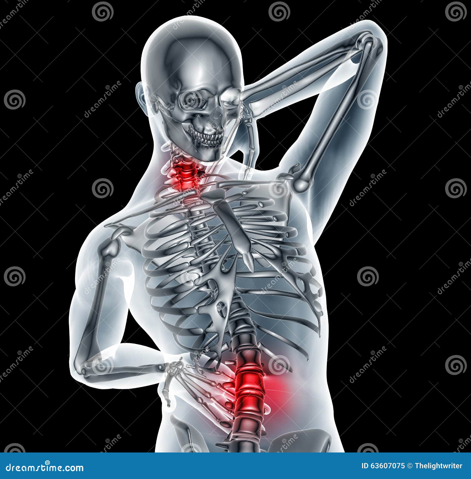 X-ray Image Man with Back Pain with Clipping Path Stock Illustration ...