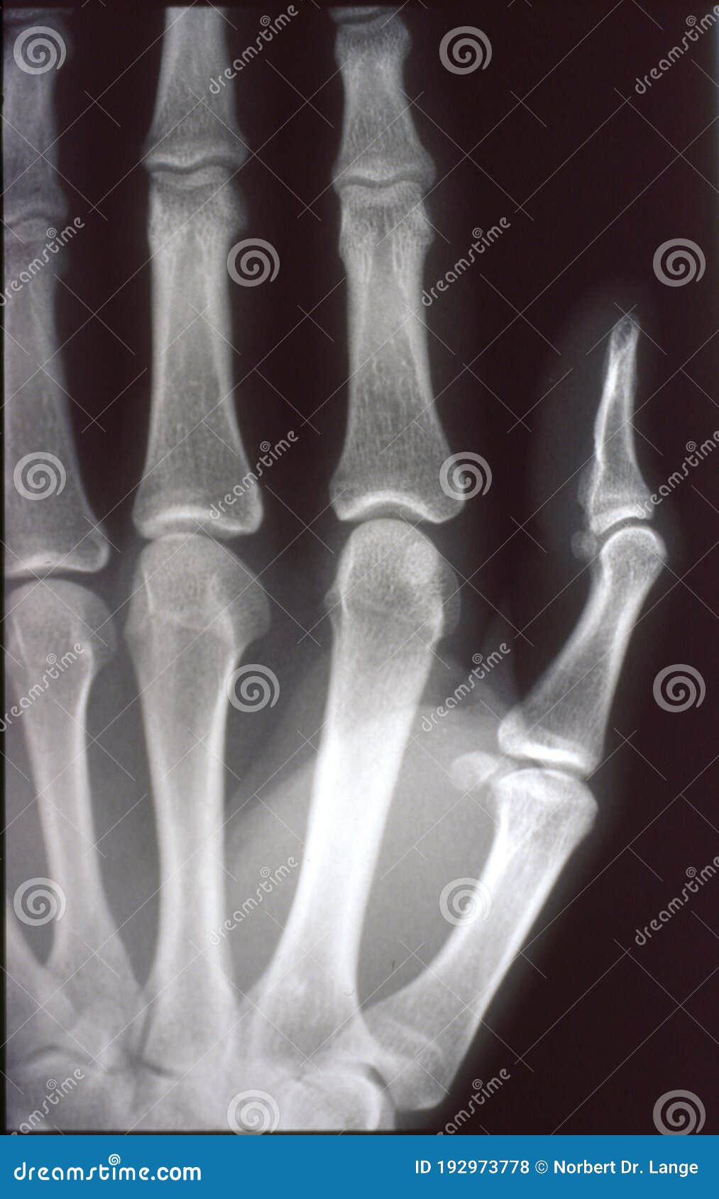 Hand Bones Pencil Drawing Royalty-Free Stock Image | CartoonDealer.com ...