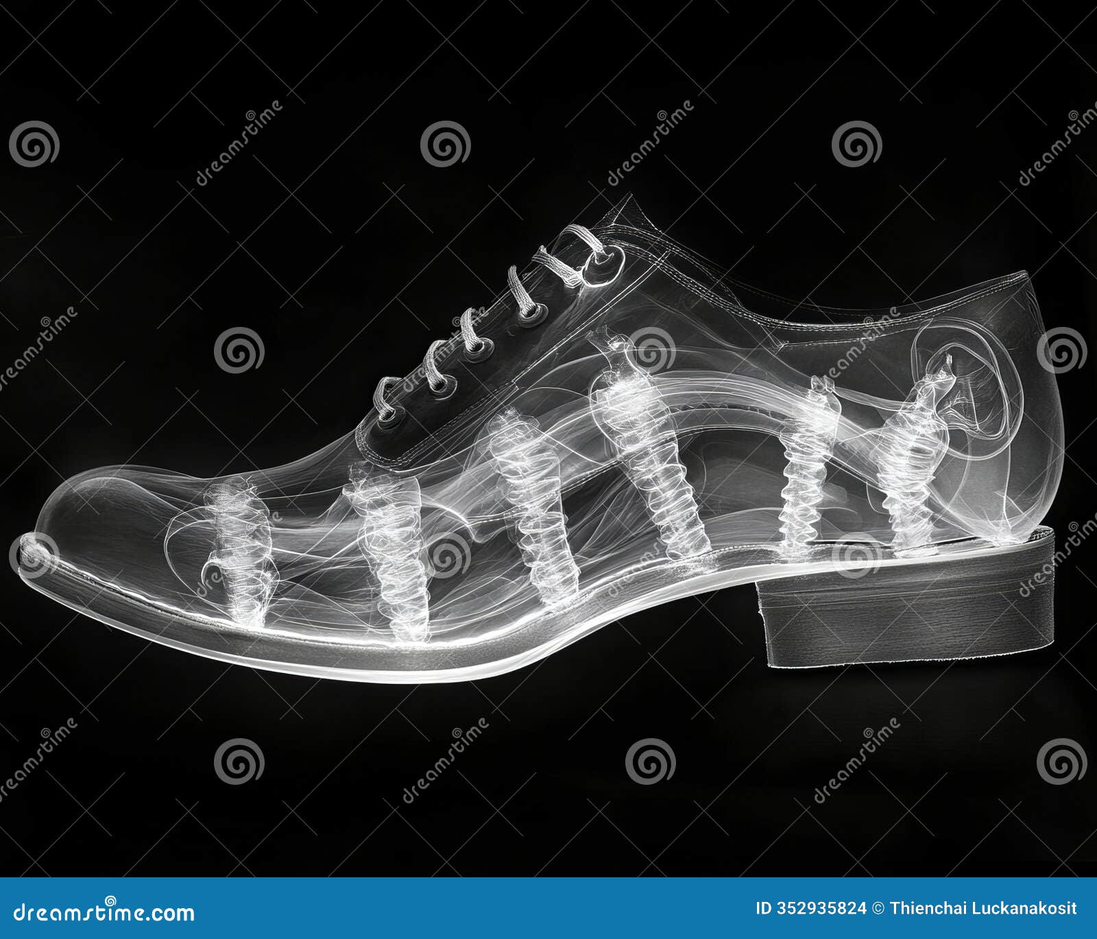 X Ray Image of Shoe Showcasing Its Inner Support Structure and Design ...