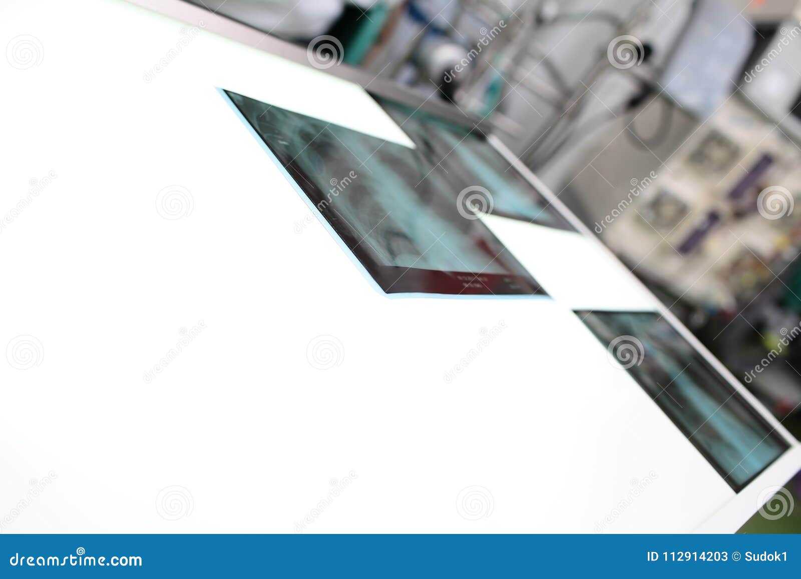 X-ray Images on the Light Box in the Hospital Room Stock Image - Image ...