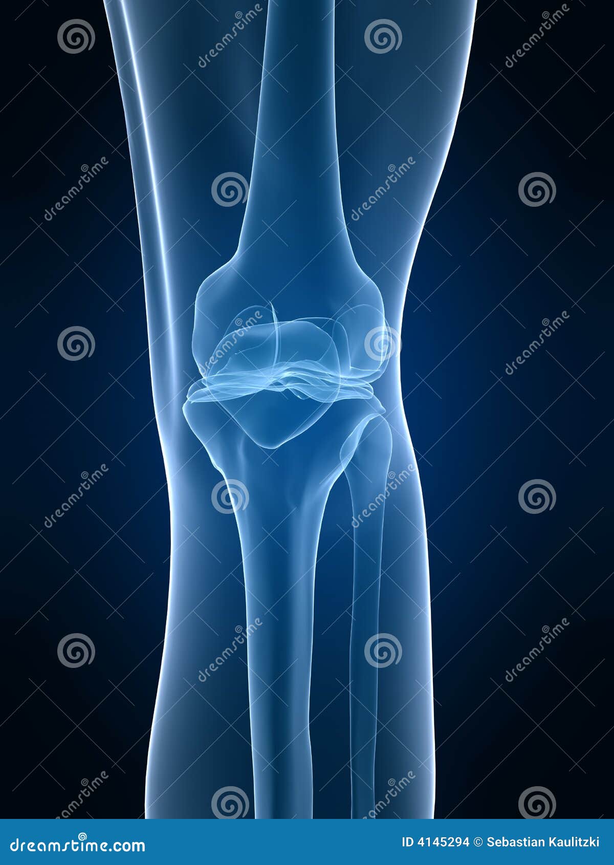 X-ray knee stock illustration. Illustration of knee, medical - 4145294